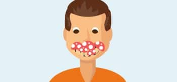 Mundpilz - was tun? - 360°zahn Tipps