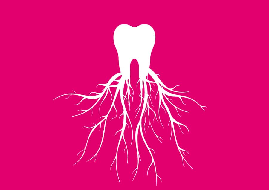 Wurzelbehandlung am Zahn | Wissenswertes Endodontie | 360°zahn