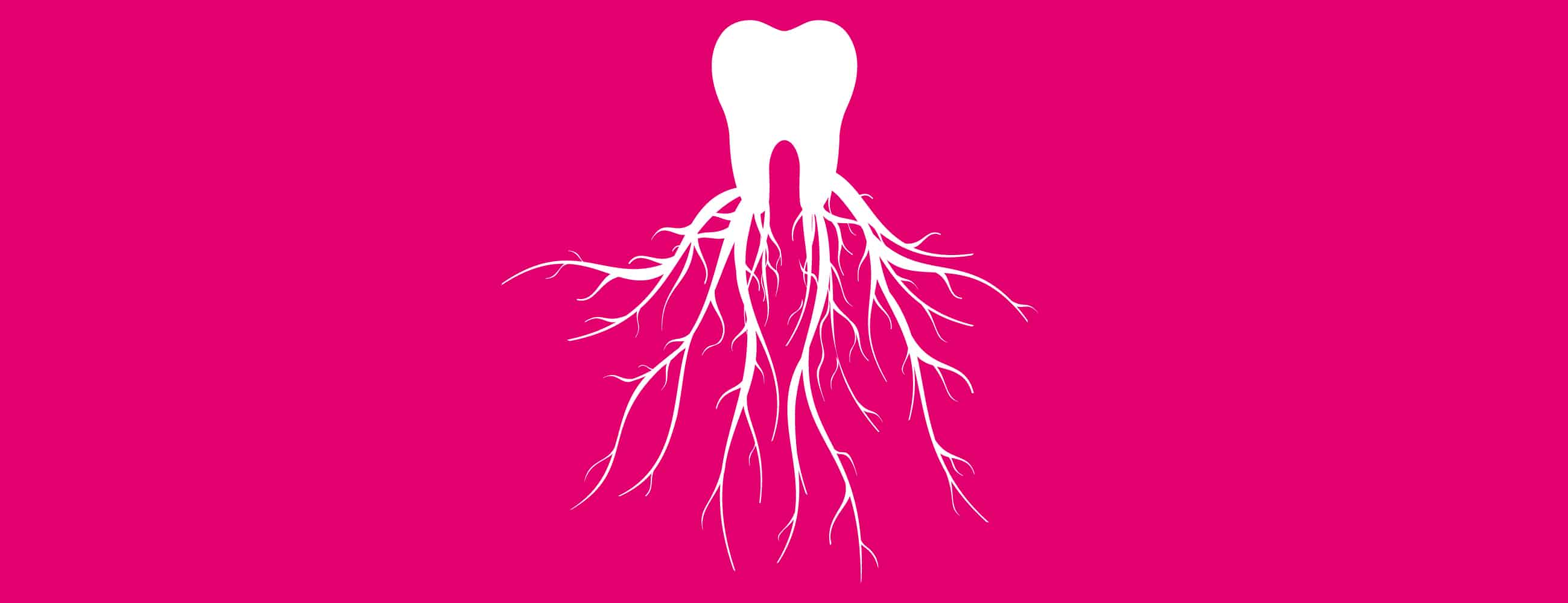 Wurzelbehandlung am Zahn | Wissenswertes Endodontie | 360°zahn